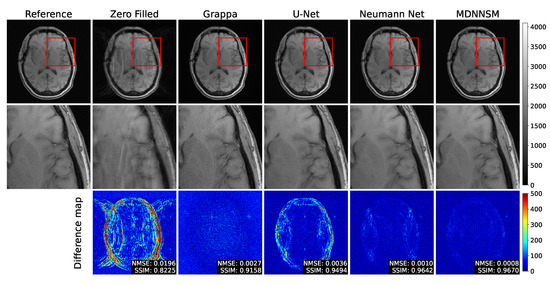 Multi-Domain Neumann Network with Sensitivity Maps for Parallel MRI ...