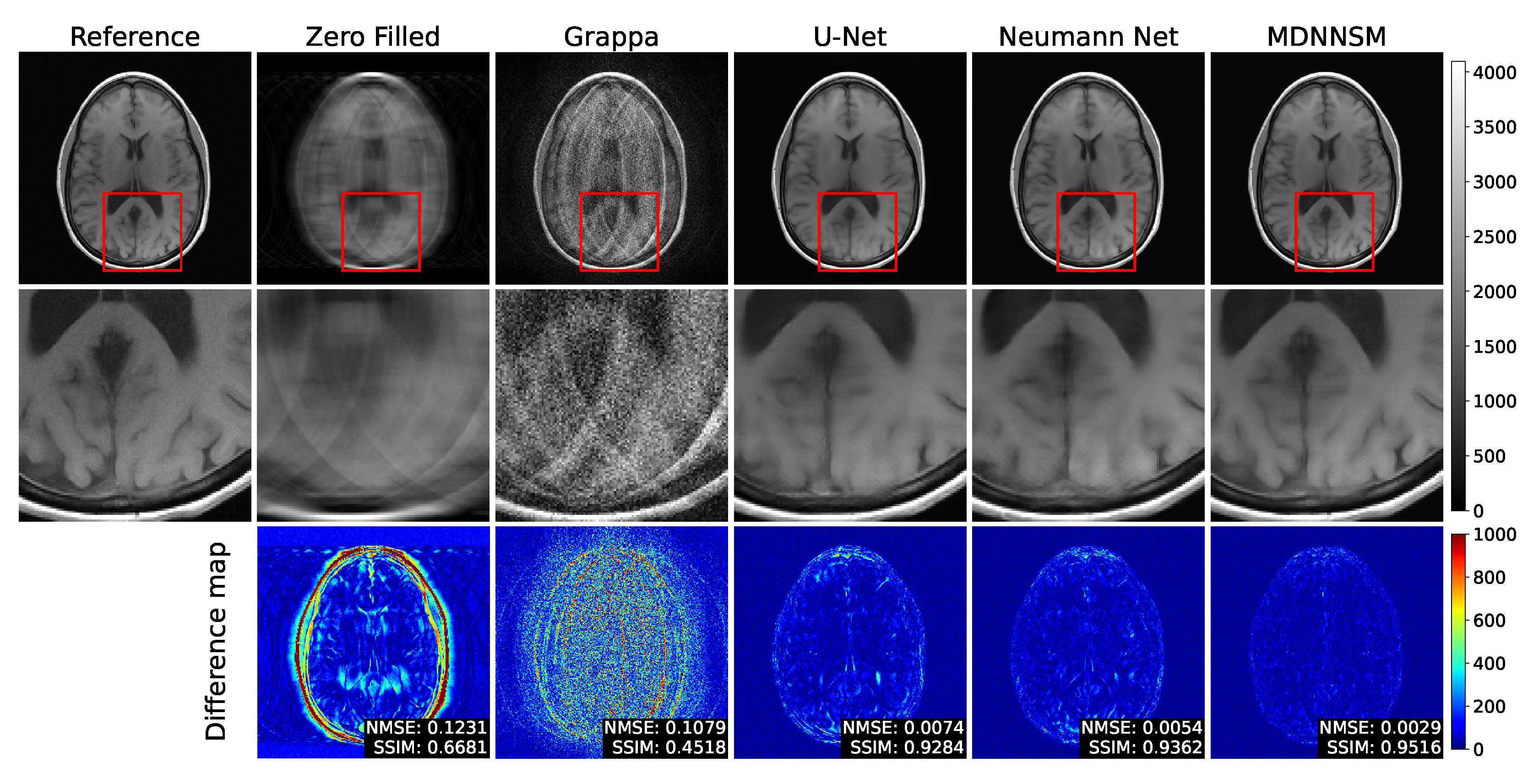 Multi-Domain Neumann Network with Sensitivity Maps for Parallel MRI Reconstruction