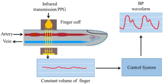 A Review of Noninvasive Methodologies to Estimate the Blood Pressure ...