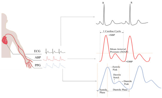 A Review of Noninvasive Methodologies to Estimate the Blood Pressure ...