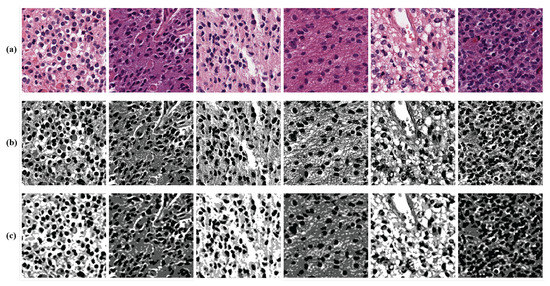 Sensors | Free Full-Text | A Novel Method Based on GAN Using a Segmentation Module for ...