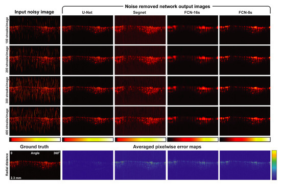 Deep-Learning-Based Algorithm for the Removal of Electromagnetic ...