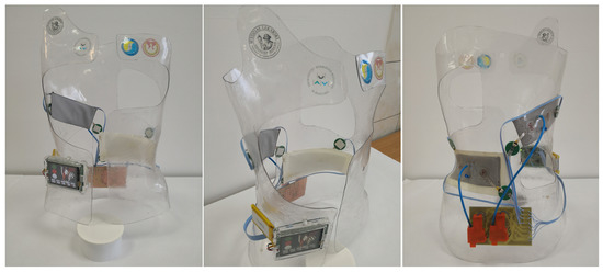 TLSO with Graphene Sensors—An Application to Measurements of Corrective ...