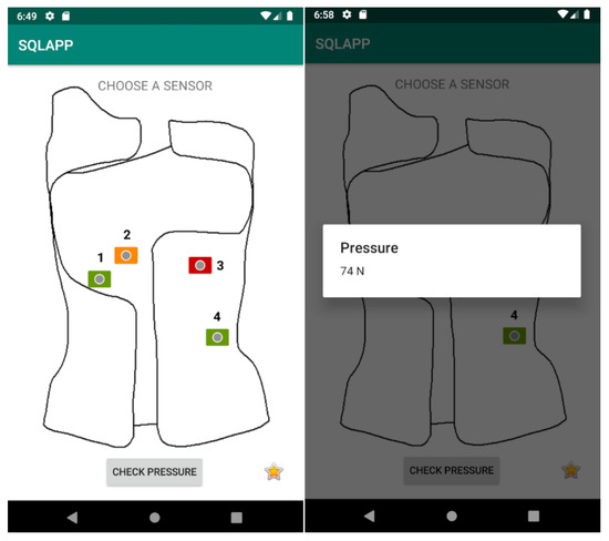 TLSO with Graphene Sensors—An Application to Measurements of Corrective ...