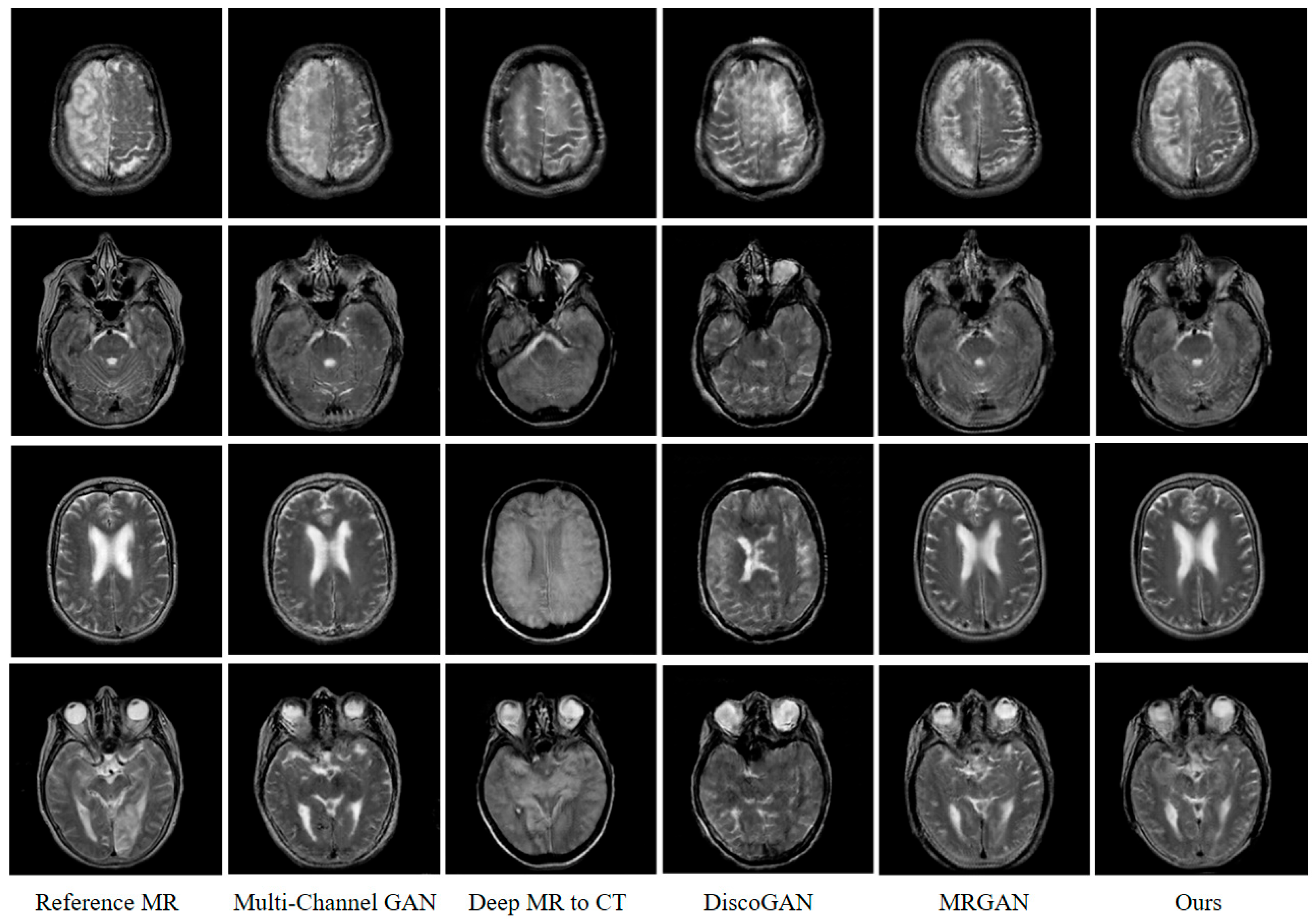 Multi-Conditional Constraint Generative Adversarial Network-Based MR Imaging from CT Scan Data