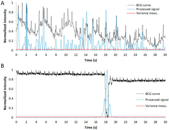 Sensors | Free Full-Text | Digital Optical Ballistocardiographic System ...
