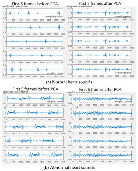 Development of an Electronic Stethoscope and a Classification Algorithm ...