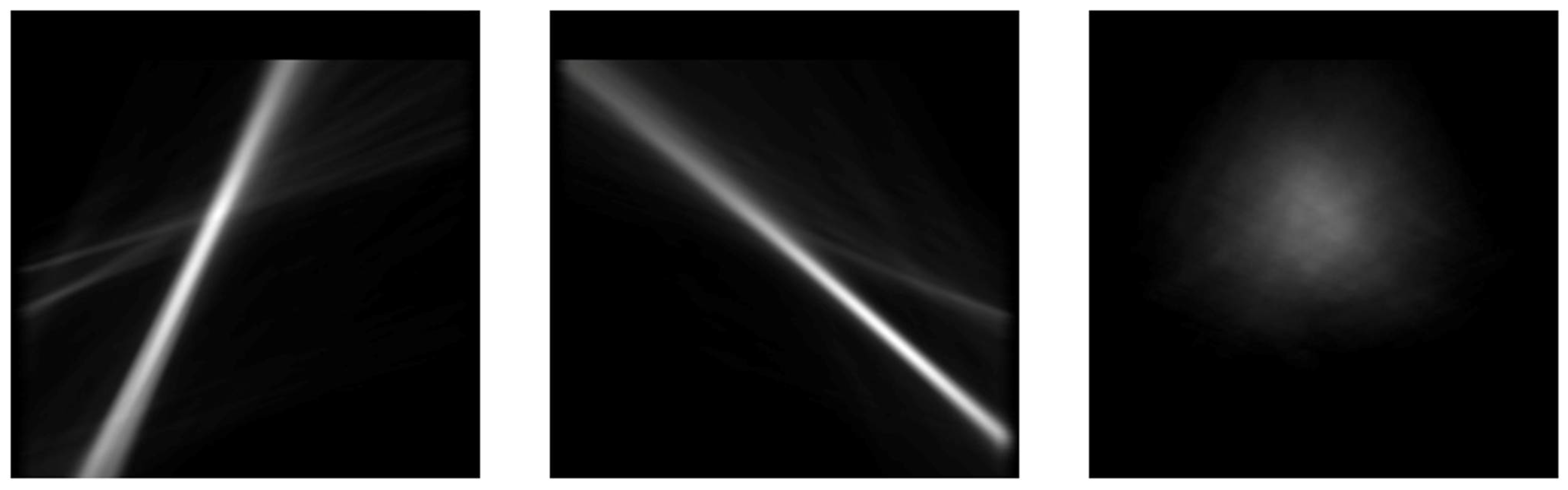 Part-Based Obstacle Detection Using a Multiple Output Neural Network