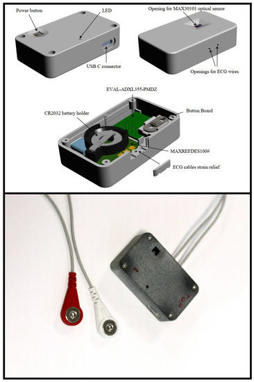 Mechanocardiography in the Detection of Acute ST Elevation Myocardial ...