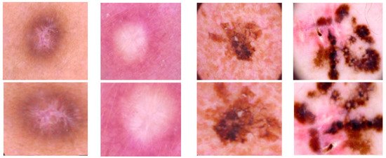 Skin Lesion Classification Using Collective Intelligence of Multiple ...