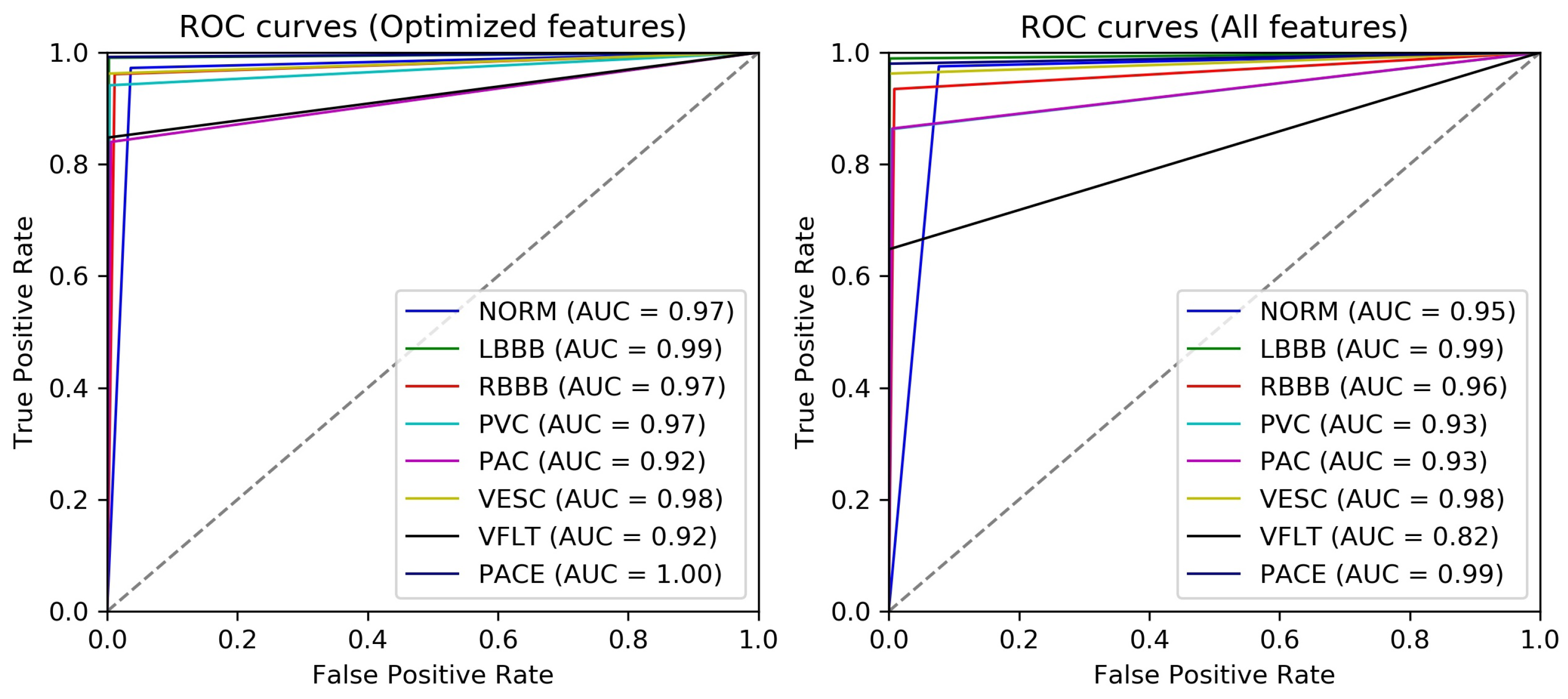 DE-PNN: Differential Evolution-Based Feature Optimization with Probabilistic Neural Network for ...