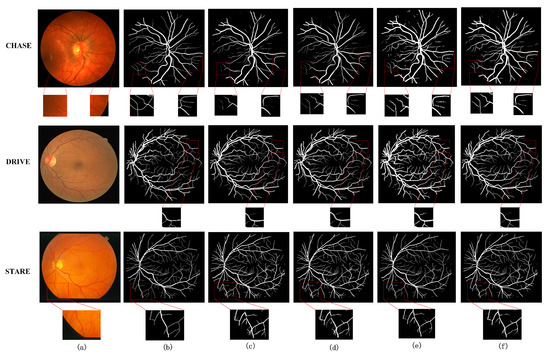 MTPA_Unet: Multi-Scale Transformer-Position Attention Retinal Vessel Segmentation Network Joint ...