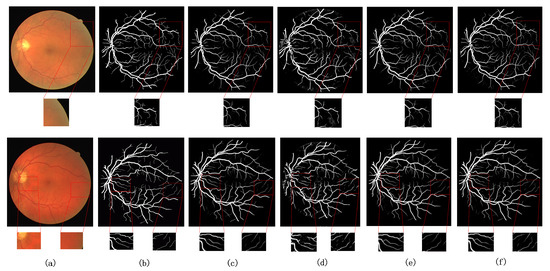 MTPA_Unet: Multi-Scale Transformer-Position Attention Retinal Vessel ...