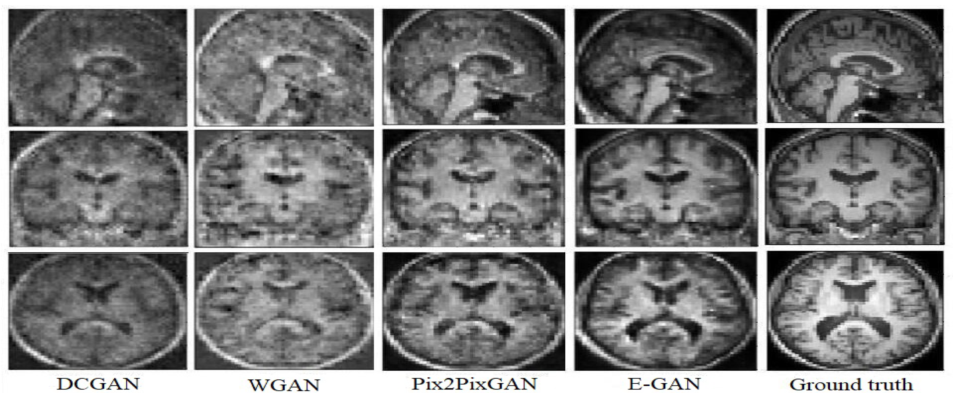 FDG-PET to T1 Weighted MRI Translation with 3D Elicit Generative ...