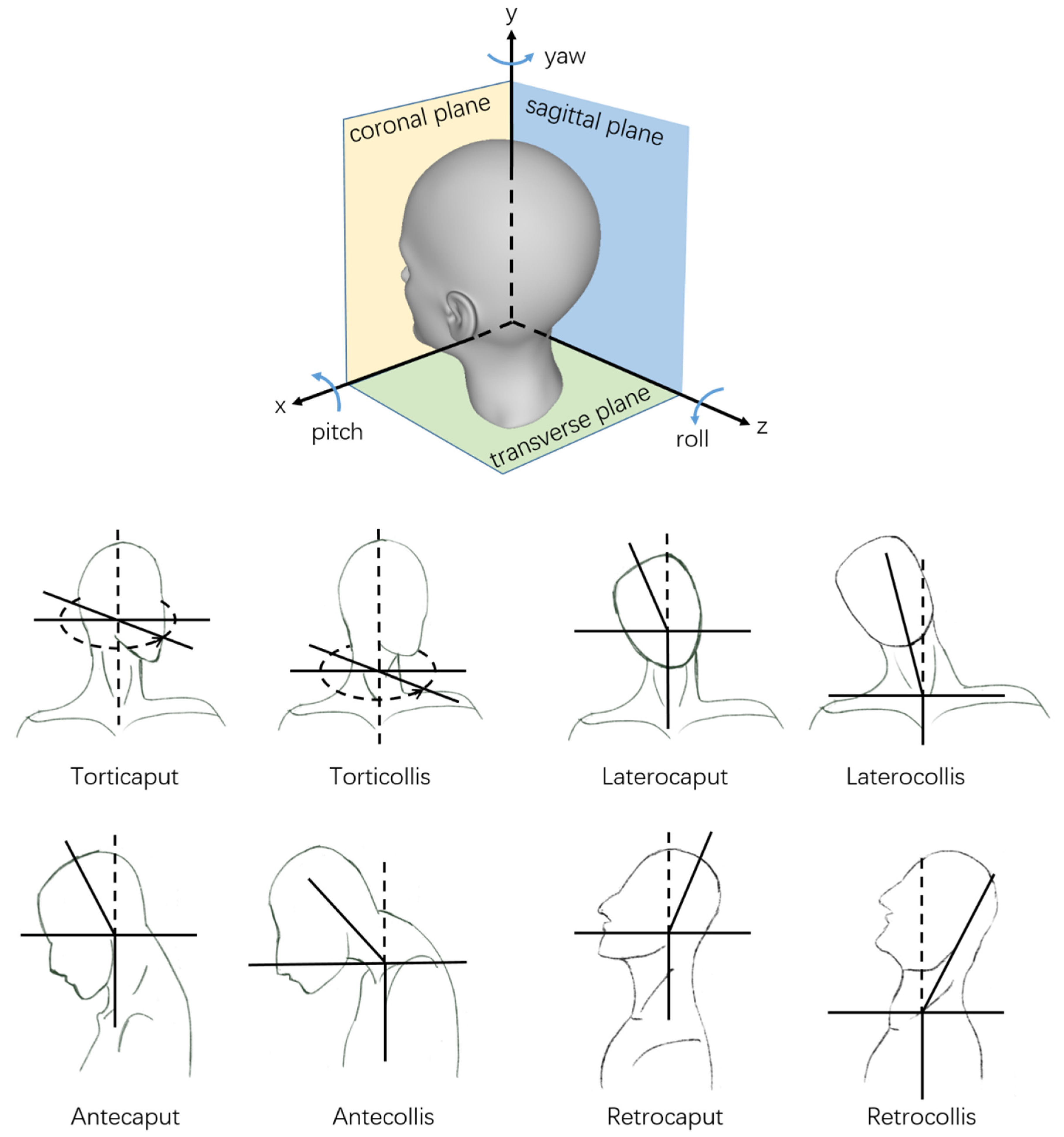 Pilot Feasibility Study of a Multi-View Vision Based Scoring Method for ...