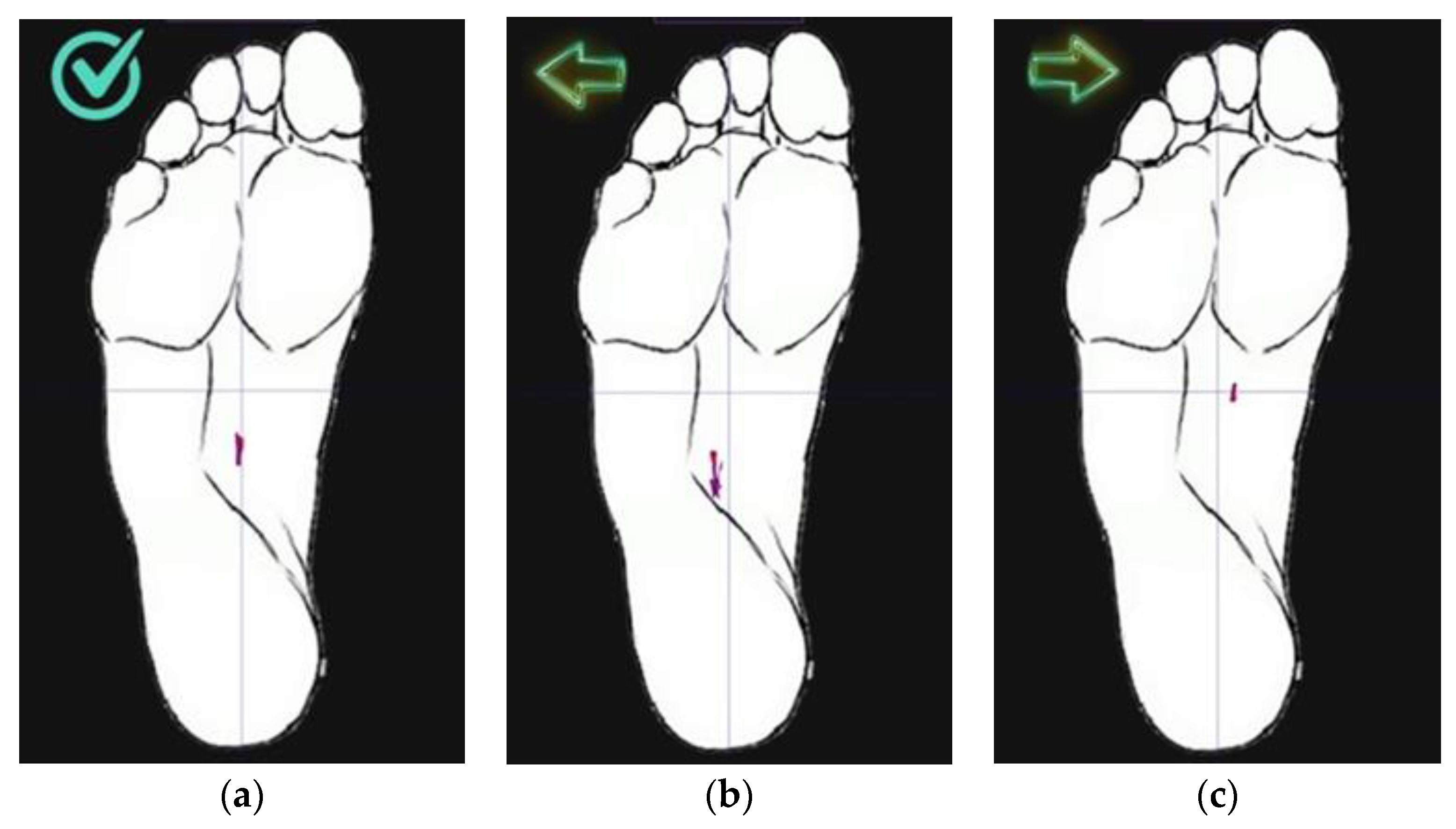 Smart Textile Sock System for Athletes’ Self-Correction during ...
