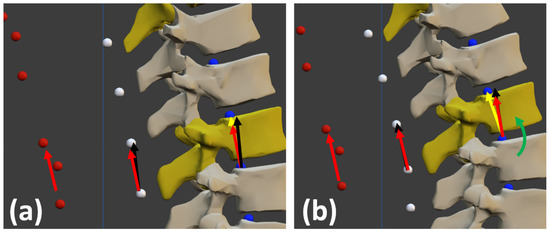 Determination of the 3D Human Spine Posture from Wearable Inertial ...