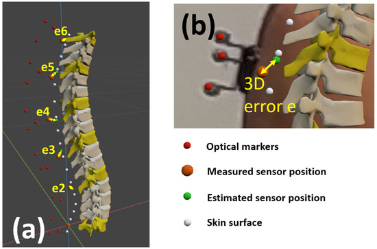 Determination of the 3D Human Spine Posture from Wearable Inertial ...