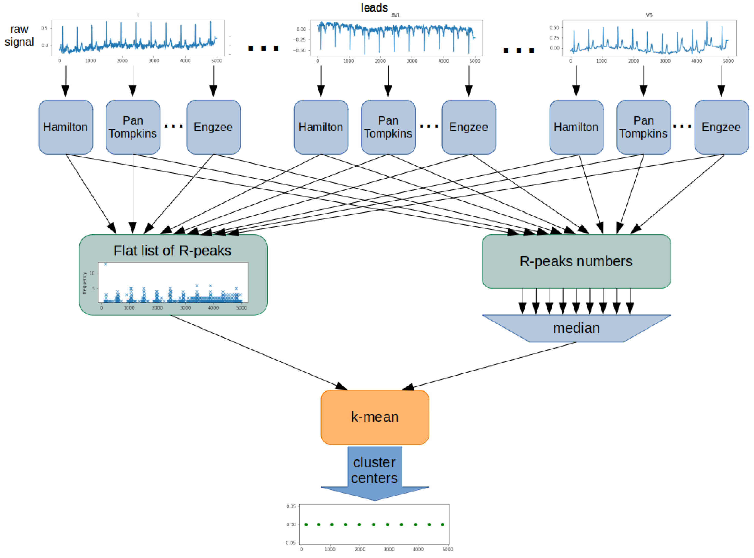 ECG Classification Using Orthogonal Matching Pursuit and Machine Learning
