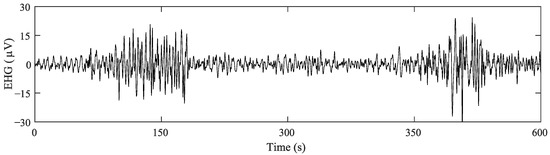 Combination of Feature Selection and Resampling Methods to Predict ...