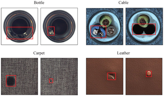 Dual Attention-Based Industrial Surface Defect Detection with ...