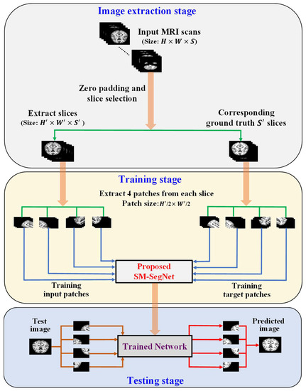 Sensors | Free Full-Text | SM-SegNet: A Lightweight Squeeze M-SegNet ...