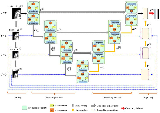 Sensors | Free Full-Text | SM-SegNet: A Lightweight Squeeze M-SegNet ...