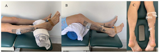 Inertia Sensors for Measuring Spasticity of the Ankle Plantarflexors ...