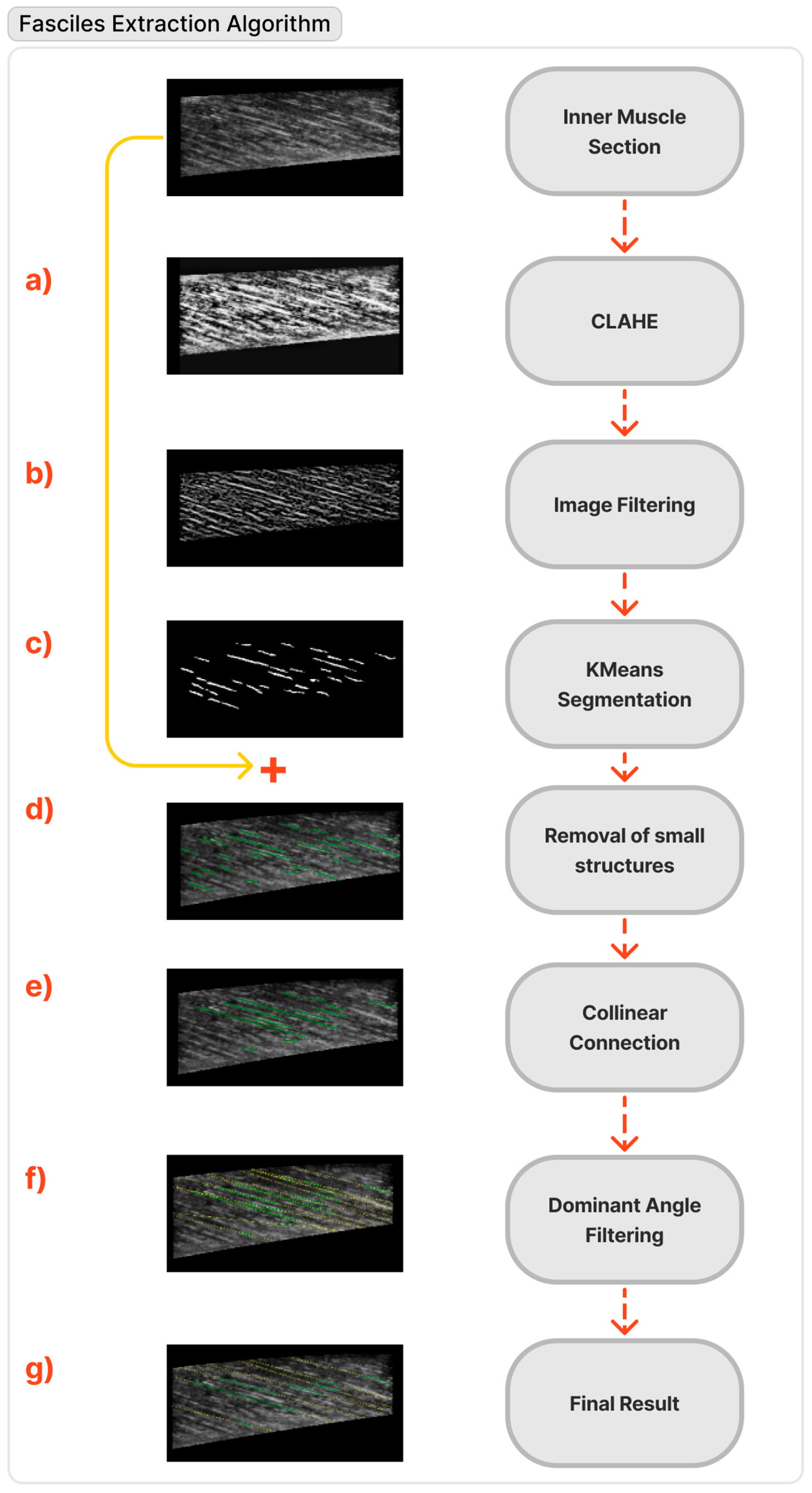 Automatic Extraction of Muscle Parameters with Attention UNet in ...