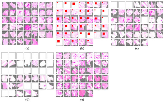 Sensors | Free Full-Text | Validating Automatic Concept-Based Explanations for AI-Based Digital ...