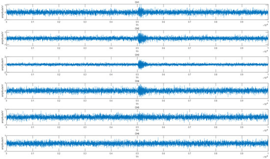 Sensors | Free Full-Text | Dir-MUSIC Algorithm for DOA Estimation of Partial Discharge Based on ...