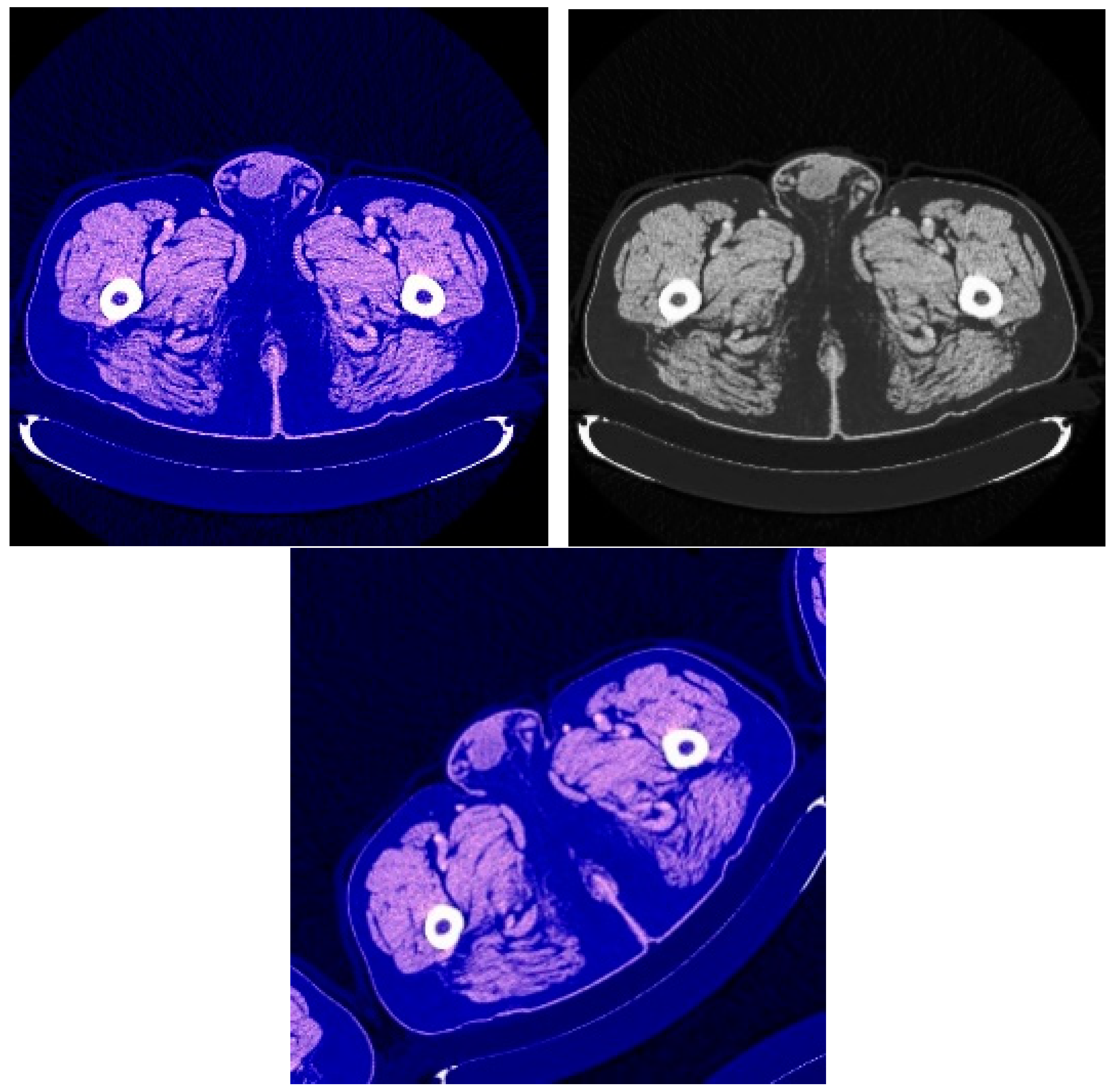 Automatic Detection of Liver Cancer Using Hybrid Pre-Trained Models