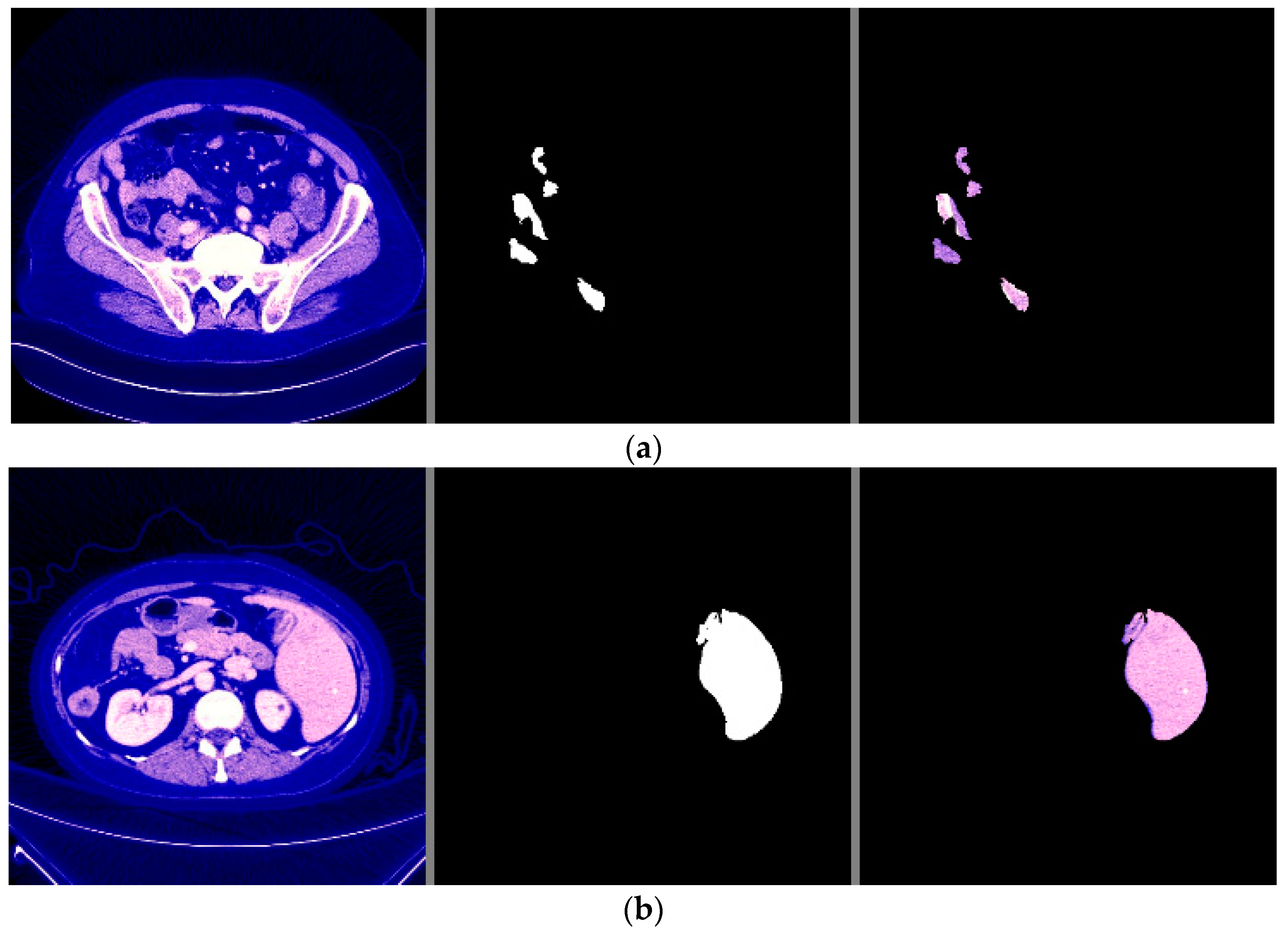 Automatic Detection of Liver Cancer Using Hybrid Pre-Trained Models