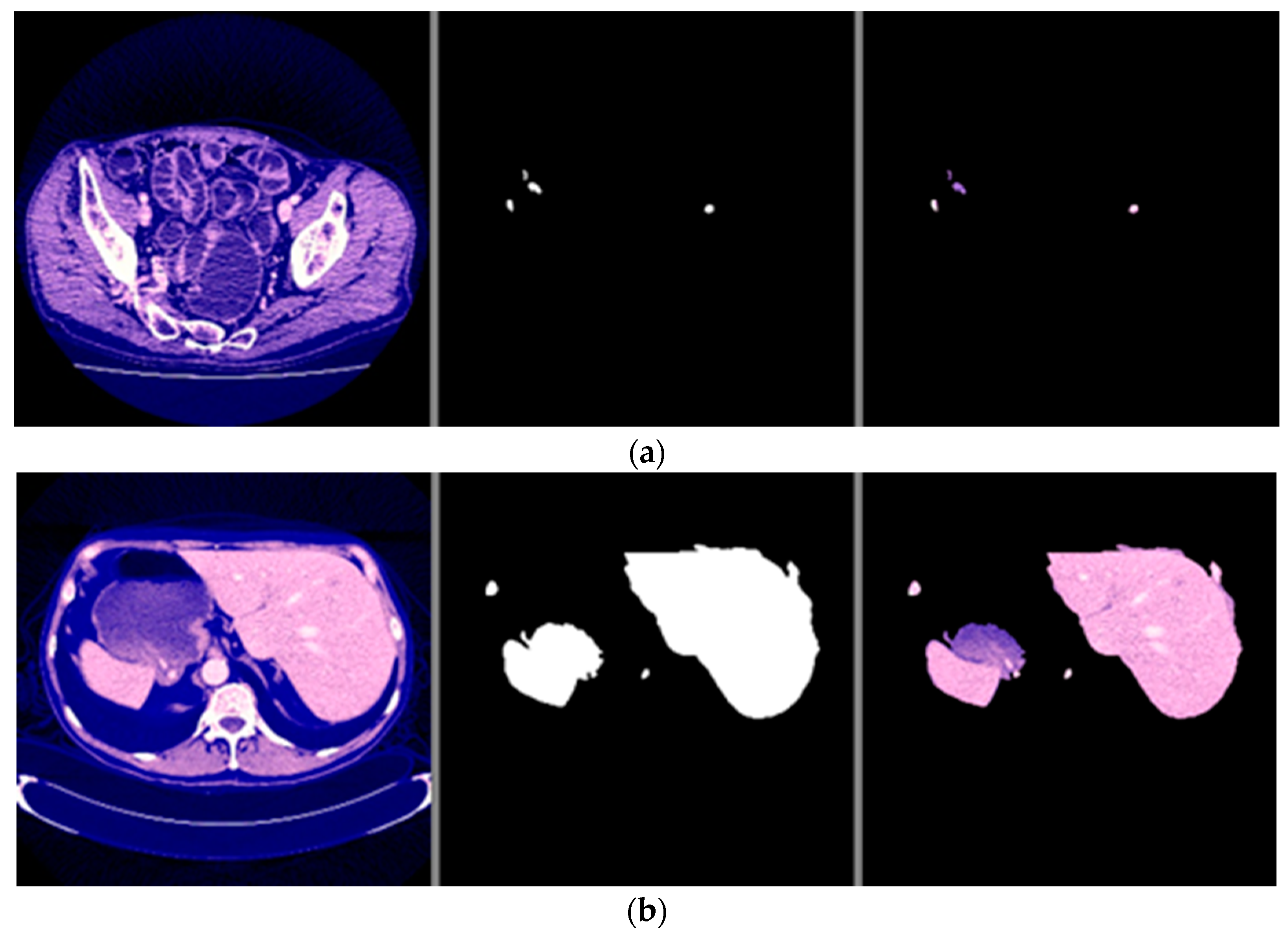 Automatic Detection of Liver Cancer Using Hybrid Pre-Trained Models
