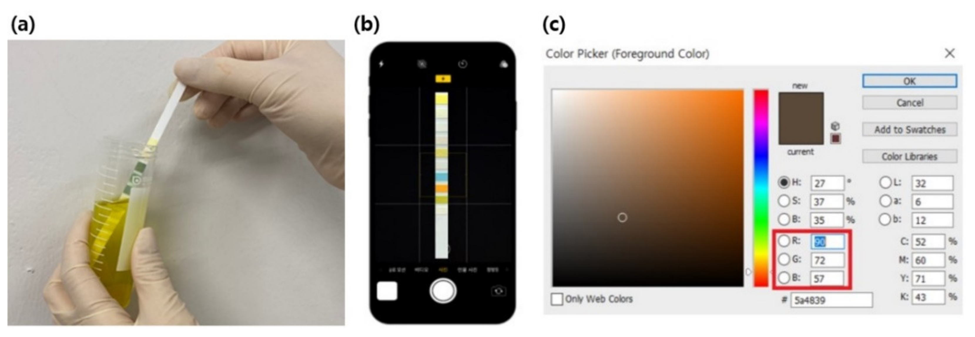 Predictive System Implementation to Improve the Accuracy of Urine Self ...