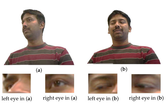 Gaze Estimation Approach Using Deep Differential Residual Network