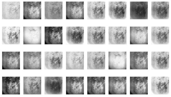 Automated Precancerous Lesion Screening Using an Instance Segmentation ...