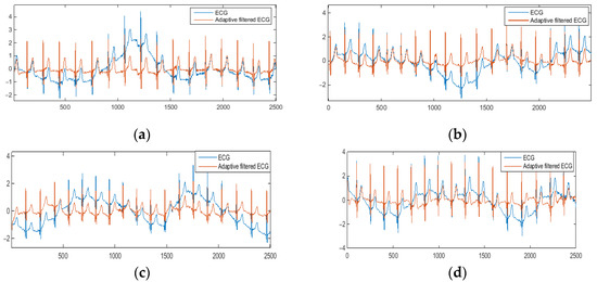 Adaptive Motion Artifact Reduction in Wearable ECG Measurements Using ...