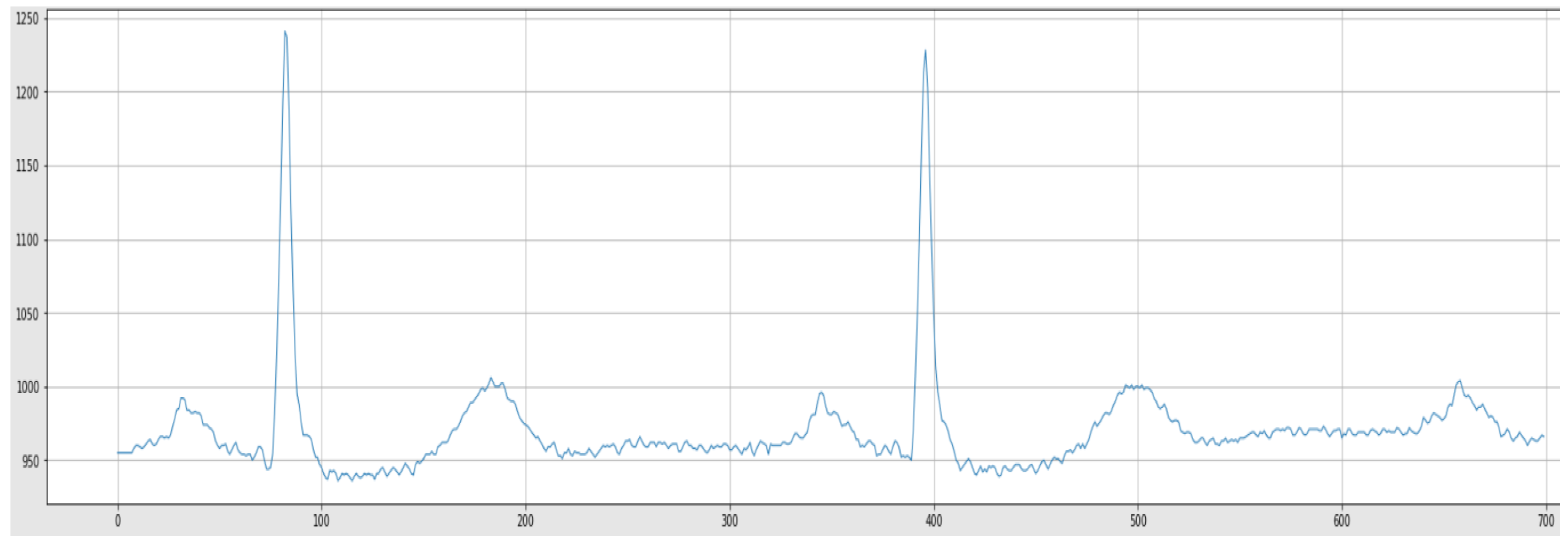 Heartbeat Classification and Arrhythmia Detection Using a Multi-Model ...