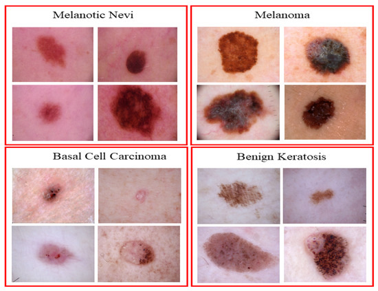 Sensors | Free Full-Text | SCDNet: A Deep Learning-Based Framework for ...