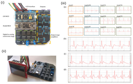 ECG Patient Simulator Based on Mathematical Models