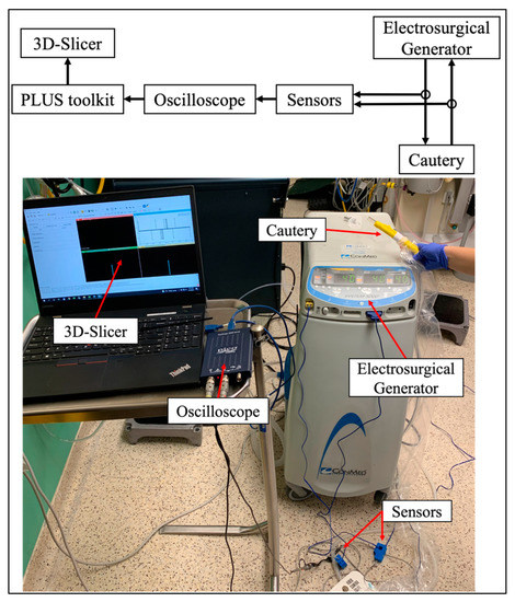 Sensor-Based Automated Detection of Electrosurgical Cautery States
