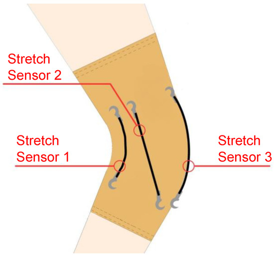 Smart Brace for Static and Dynamic Knee Laxity Measurement