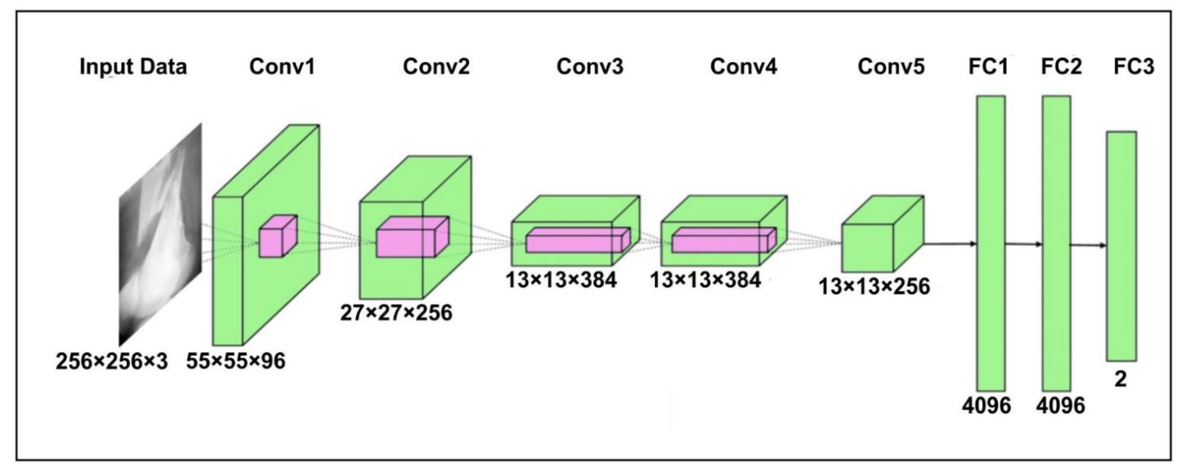 Bone Fracture Detection Using Neural Network Matlab P