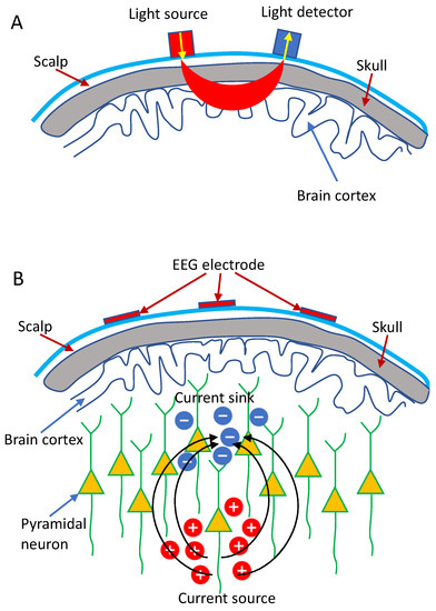Sensors | Free Full-Text | Concurrent fNIRS and EEG for Brain Function ...