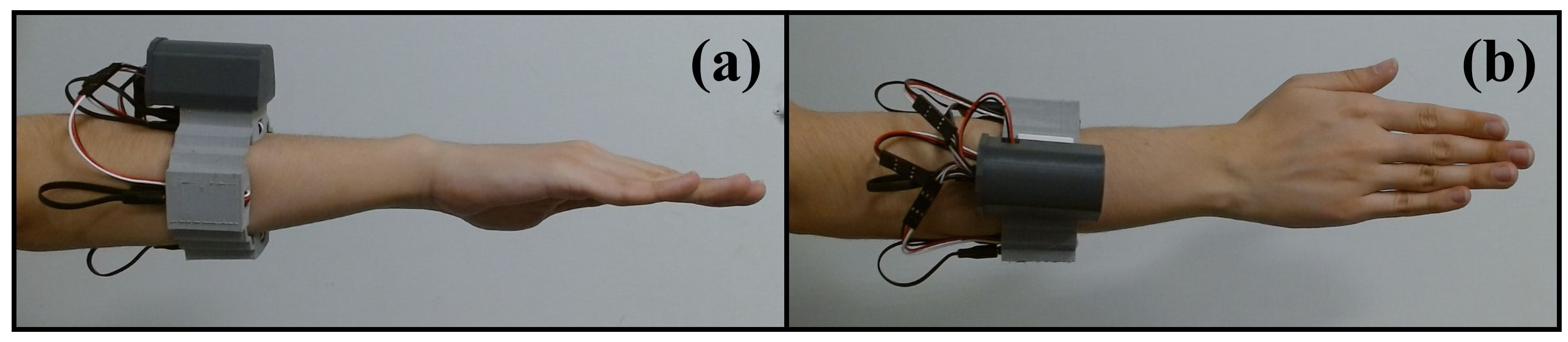Low-Cost Wearable Band Sensors of Surface Electromyography for ...