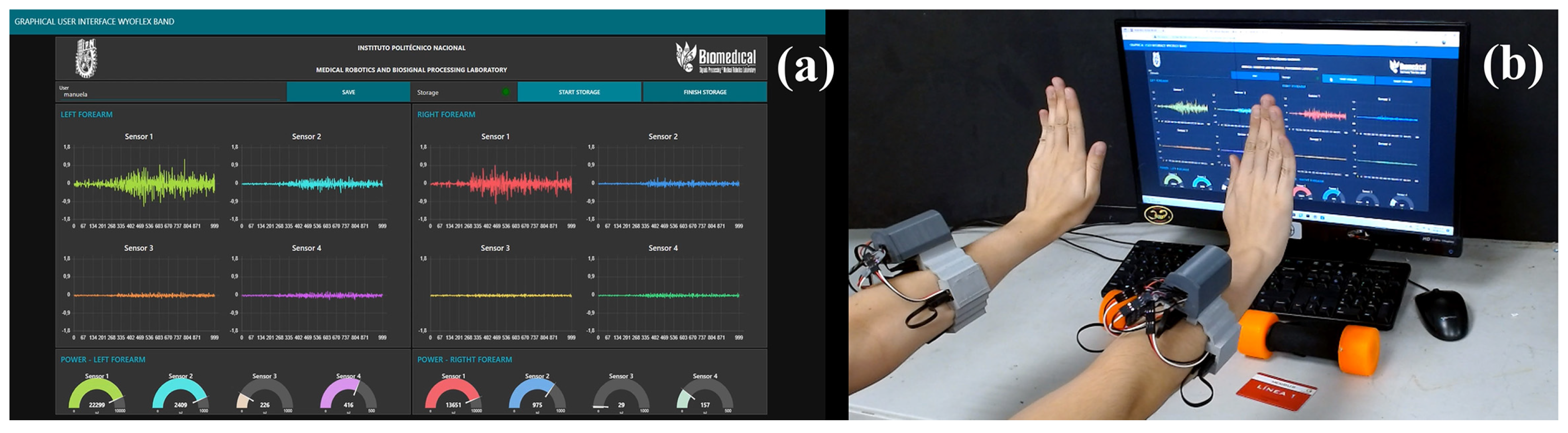 Low-Cost Wearable Band Sensors of Surface Electromyography for ...