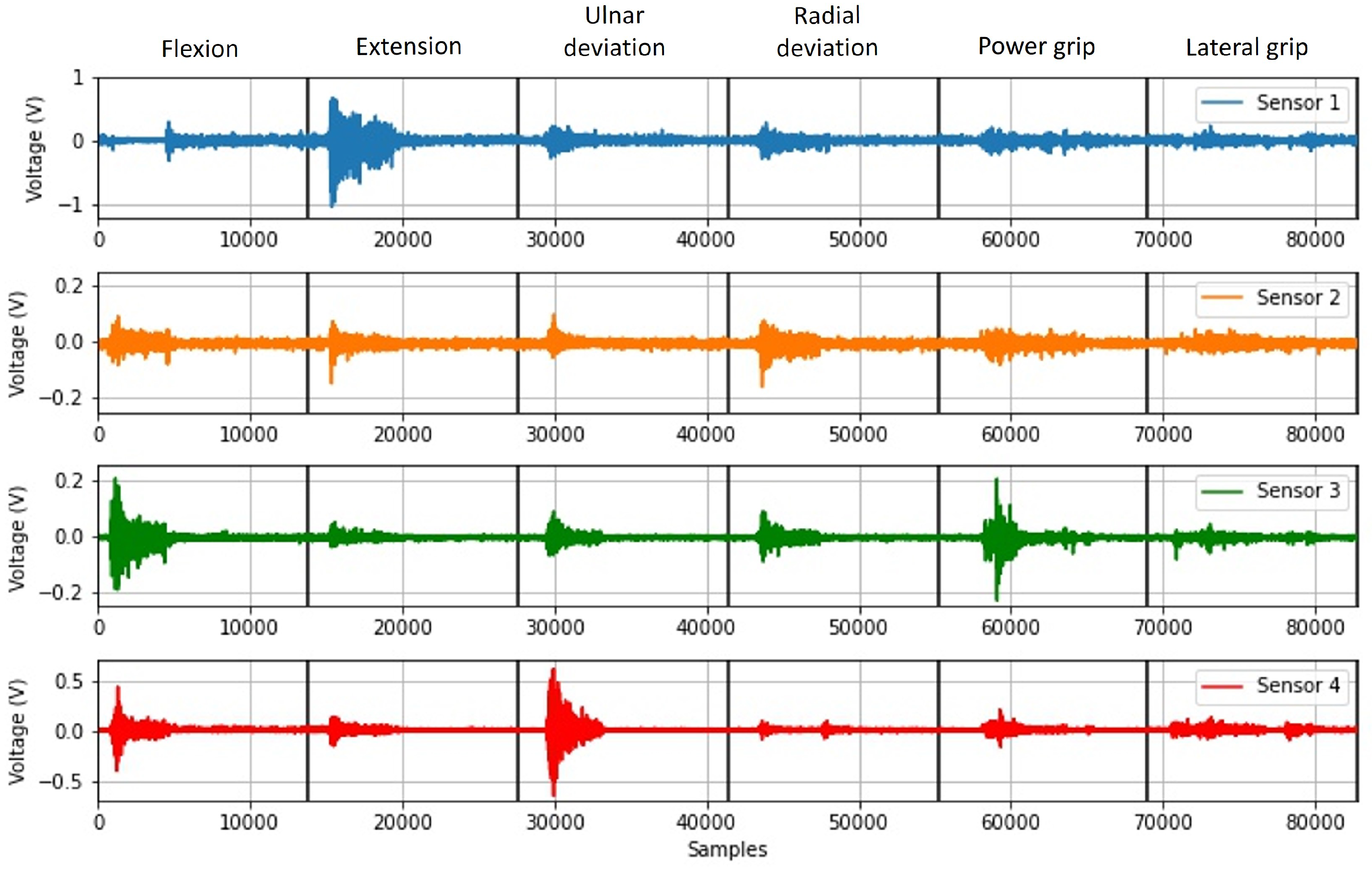Low-Cost Wearable Band Sensors of Surface Electromyography for ...