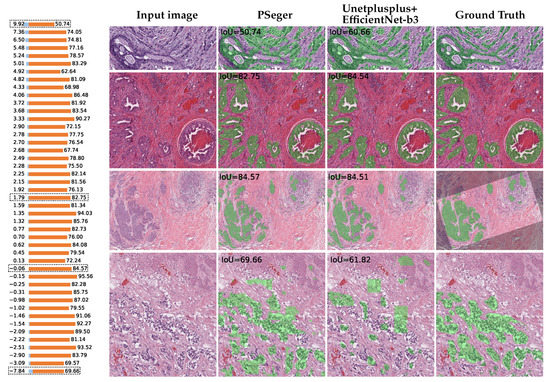 Using Sparse Patch Annotation for Tumor Segmentation in ...