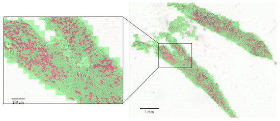 Using Sparse Patch Annotation for Tumor Segmentation in Histopathological Images